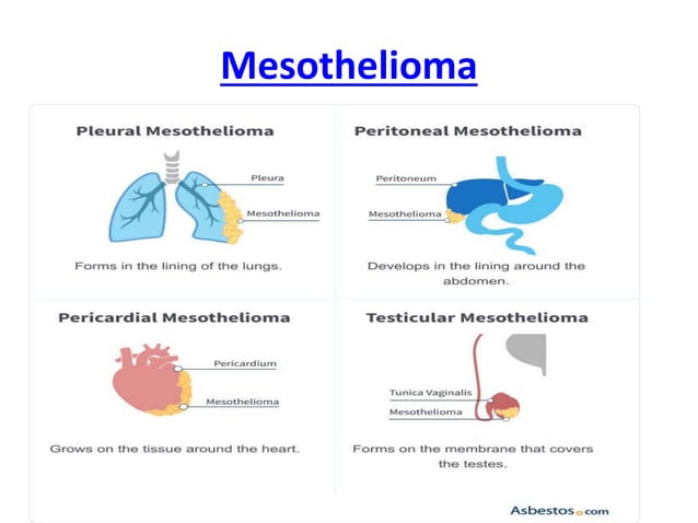 Effusions peritoneal fluids.pptx