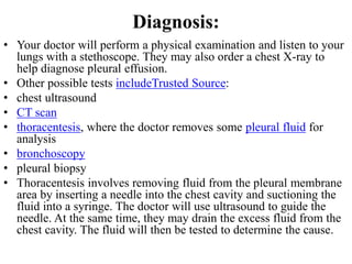 Effusions pleural.pptx