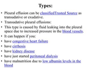Effusions pleural.pptx