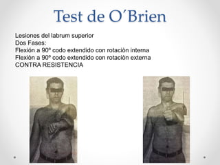 EXPLORACION FISICA DEL HOMBRO Y CARACTERISTICAS NORMALES | PPTX