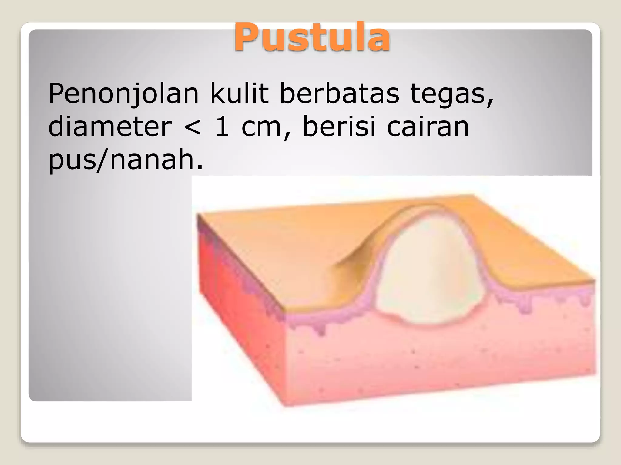 Efloresensi (modul kulit dan jaringan penunjang) | PPTX