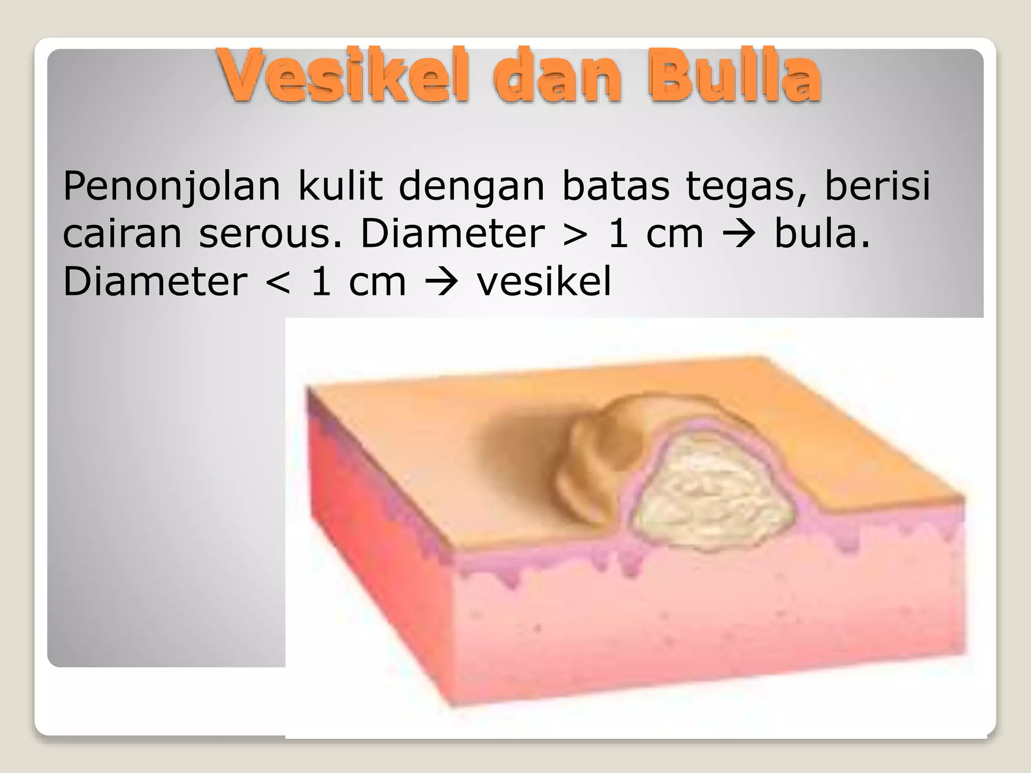 Efloresensi (modul kulit dan jaringan penunjang) | PPTX