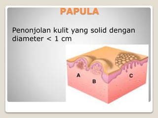 Efloresensi (modul kulit dan jaringan penunjang) | PPTX