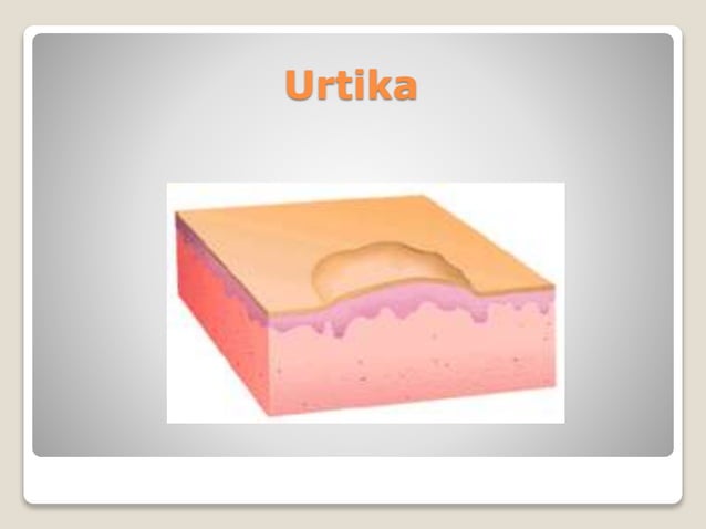 Efloresensi (modul kulit dan jaringan penunjang) | PPTX
