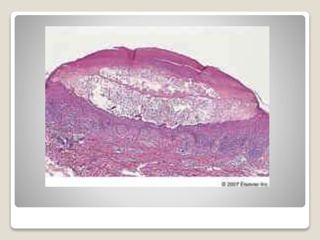 Efloresensi (modul kulit dan jaringan penunjang) | PPTX