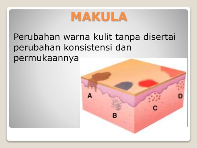 Efloresensi (modul kulit dan jaringan penunjang) | PPTX