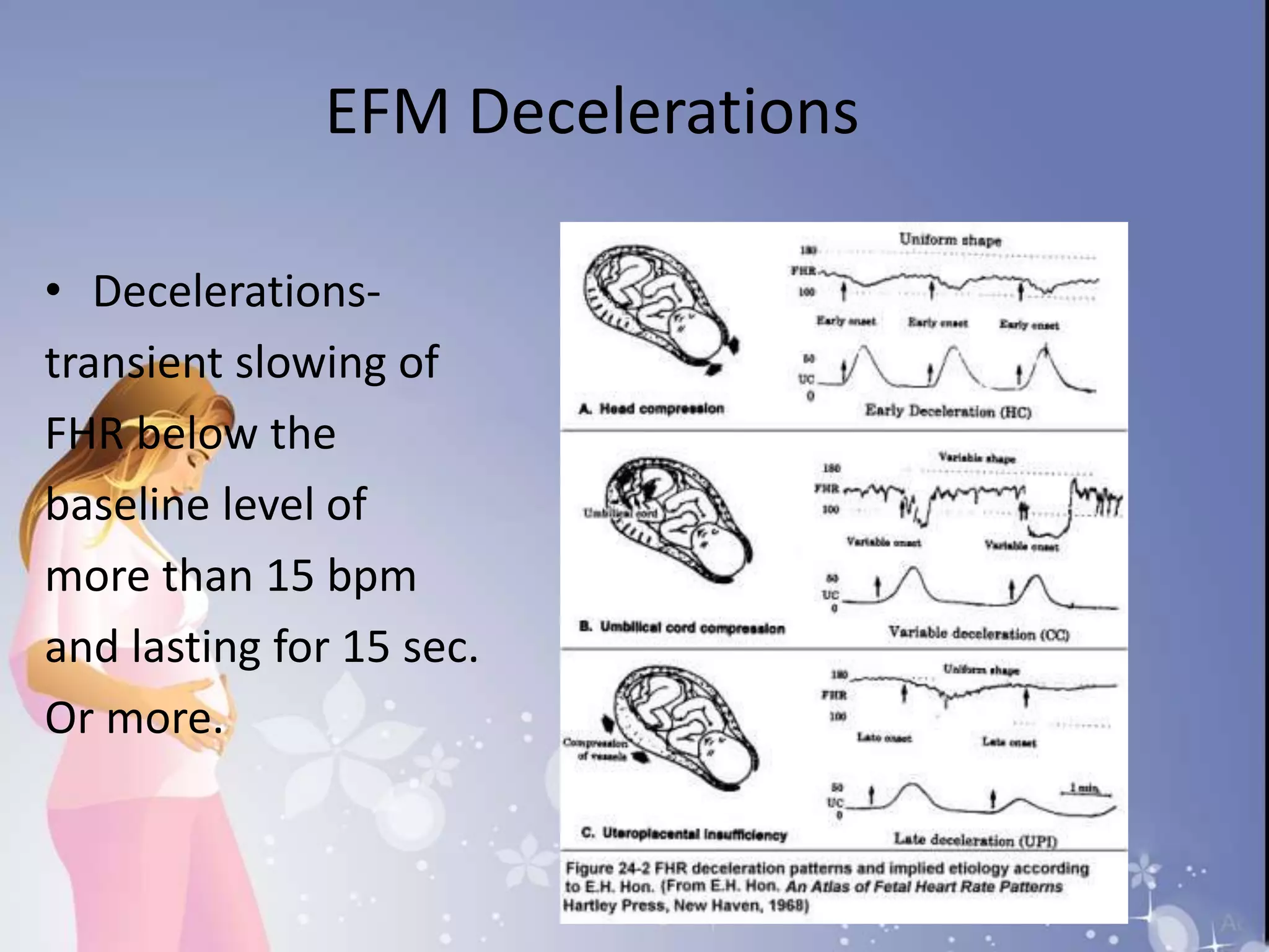 EFM- Electerical Fetal Monitoring- Legal issues,Problems,Facts, define ...