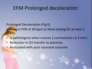 EFM- Electerical Fetal Monitoring- Legal issues,Problems,Facts, define ...