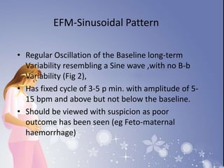 EFM- Electerical Fetal Monitoring- Legal issues,Problems,Facts, define ...