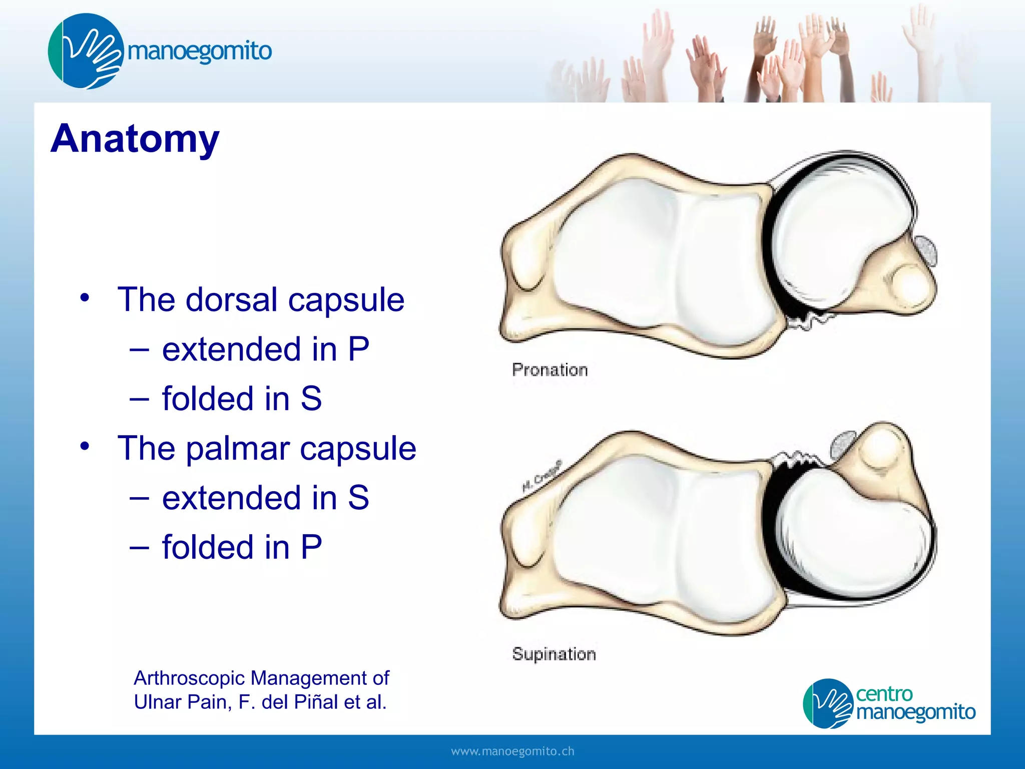 Acute Triangular Fibrocartilage Complex Injuries: Treatment ...