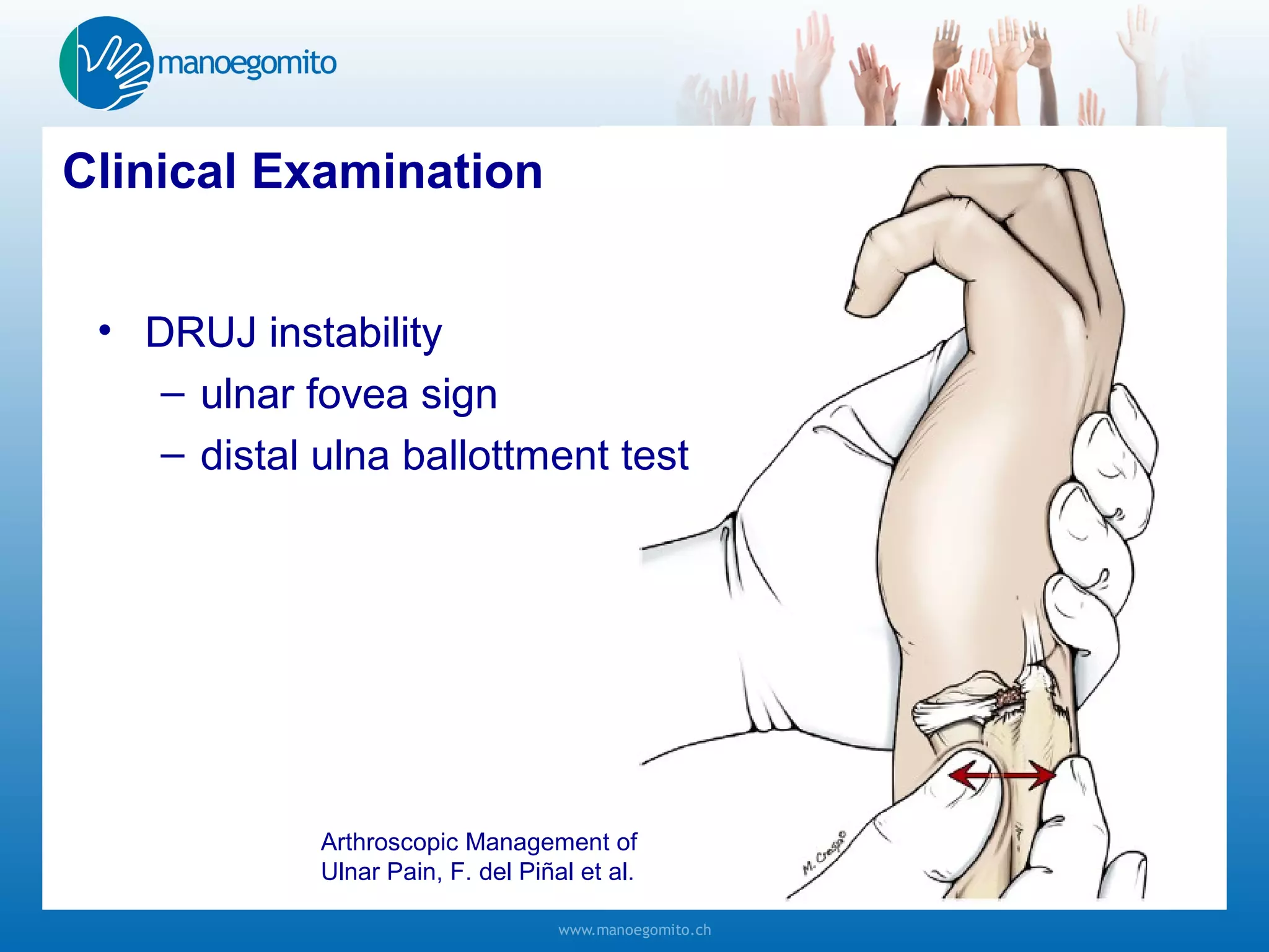 Acute Triangular Fibrocartilage Complex Injuries: Treatment ...