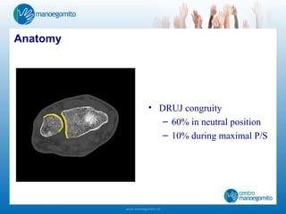 Acute Triangular Fibrocartilage Complex Injuries: Treatment ...