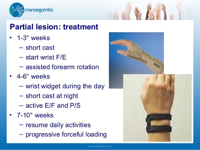 Acute Triangular Fibrocartilage Complex Injuries: Treatment & Managem…