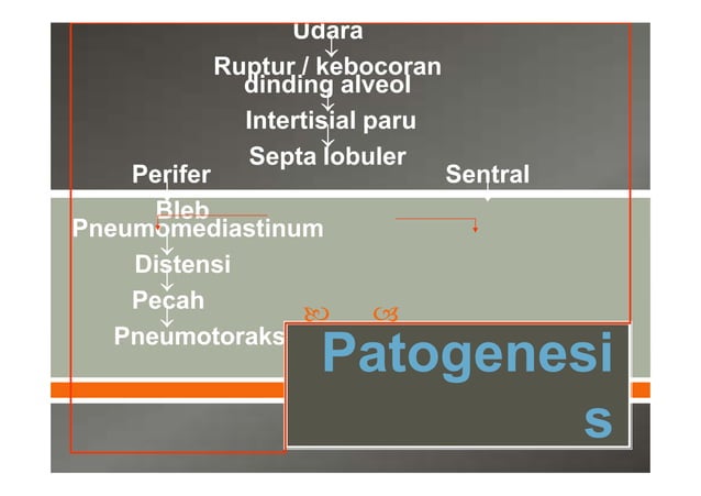 efusi-pleura-masive-Pneumotoraks (1).pptx