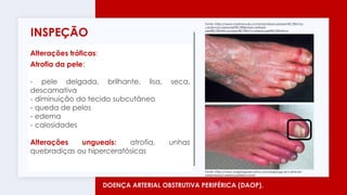 Exame Físico VASCULAR do curso de enfermagem (1).pdf