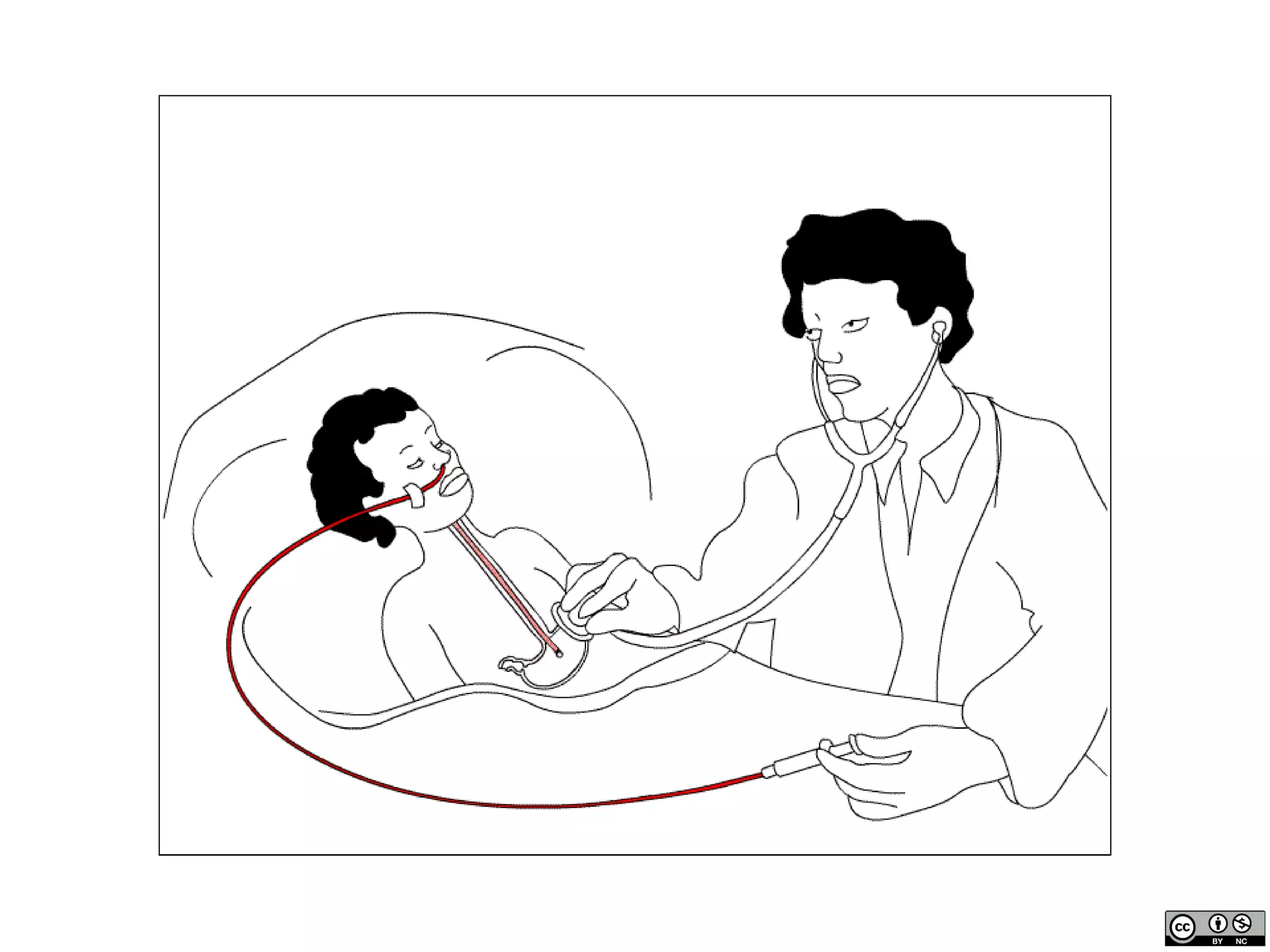 Gastric Lavage Procedure Animation | PPT