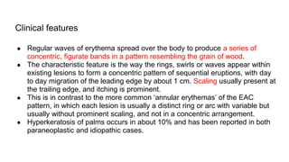 ERTHEMA GYRATUM REPENS & ERTHEMA MARGINATUM RHEUMATICUM DERMATOLOGY | PPTX