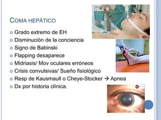 Encefalopatia Hepatica | PPTX