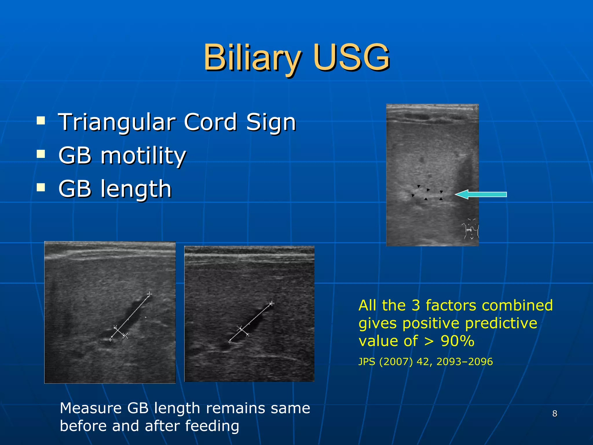 Biliary Atresia | PPT
