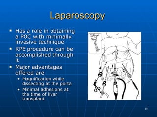 Biliary Atresia | PPT