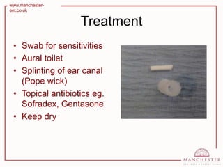 Eh ear presentation | PPT