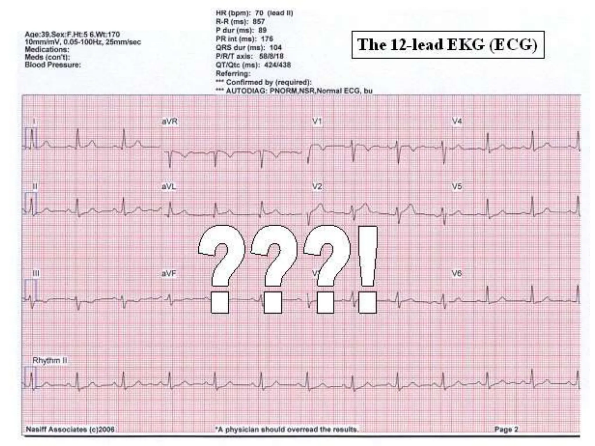 A brief introduction to the standard 12-lead ECG (EKG) | PPT