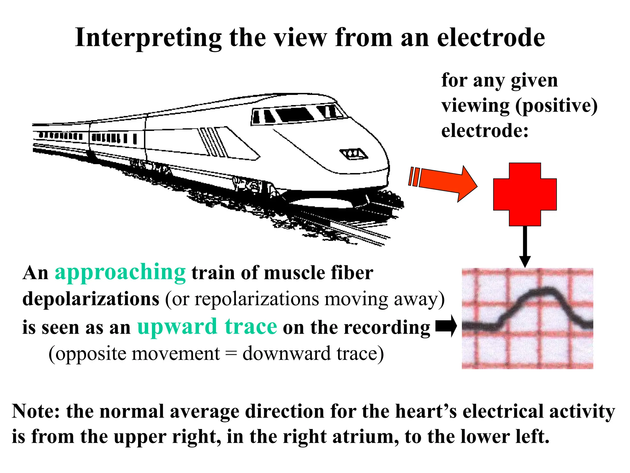A brief introduction to the standard 12-lead ECG (EKG) | PPT