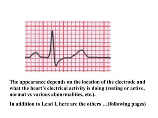 A brief introduction to the standard 12-lead ECG (EKG) | PPT