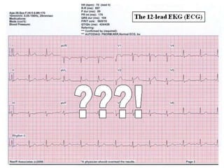 A brief introduction to the standard 12-lead ECG (EKG) | PPT