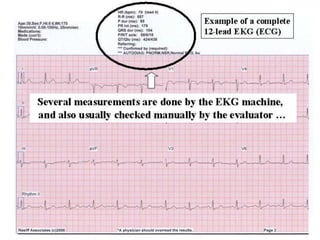 A brief introduction to the standard 12-lead ECG (EKG) | PPT