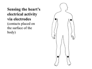 A brief introduction to the standard 12-lead ECG (EKG) | PPT