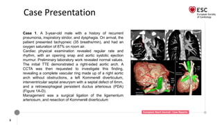 EHJ-CR-Slide-Set (1).pptx