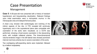 EHJ-CR-Slide-Set (1).pptx
