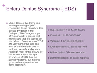 Ehlers Danlos Syndrome | PPTX