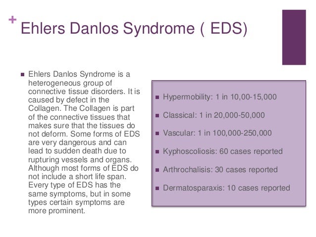 Ehlers Danlos Syndrome