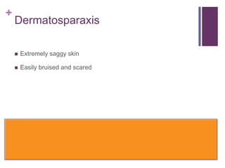 Ehlers Danlos Syndrome | PPT