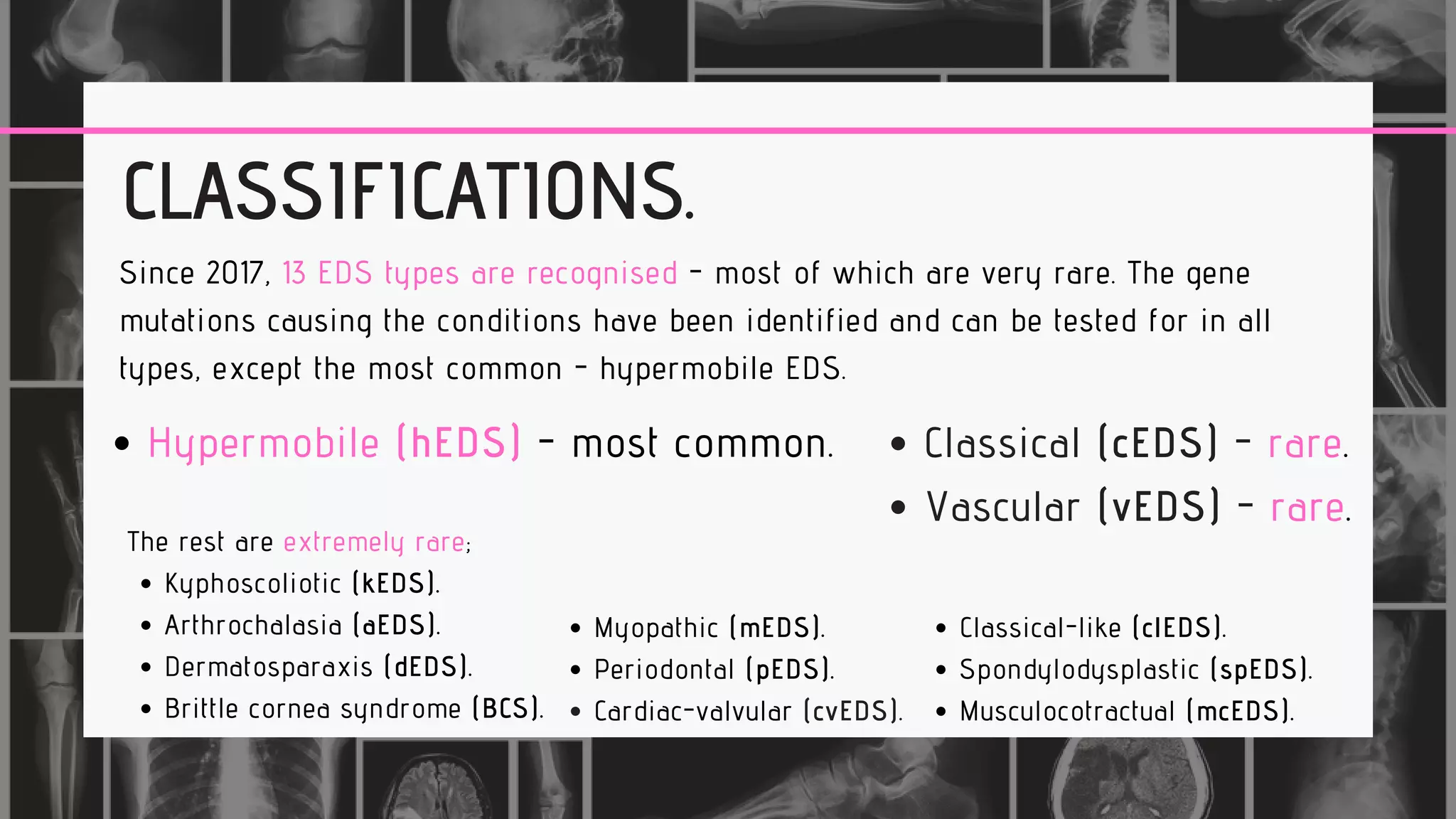Hypermobile Ehlers-Danlos Syndrome & hypermobility spectrum disorders ...