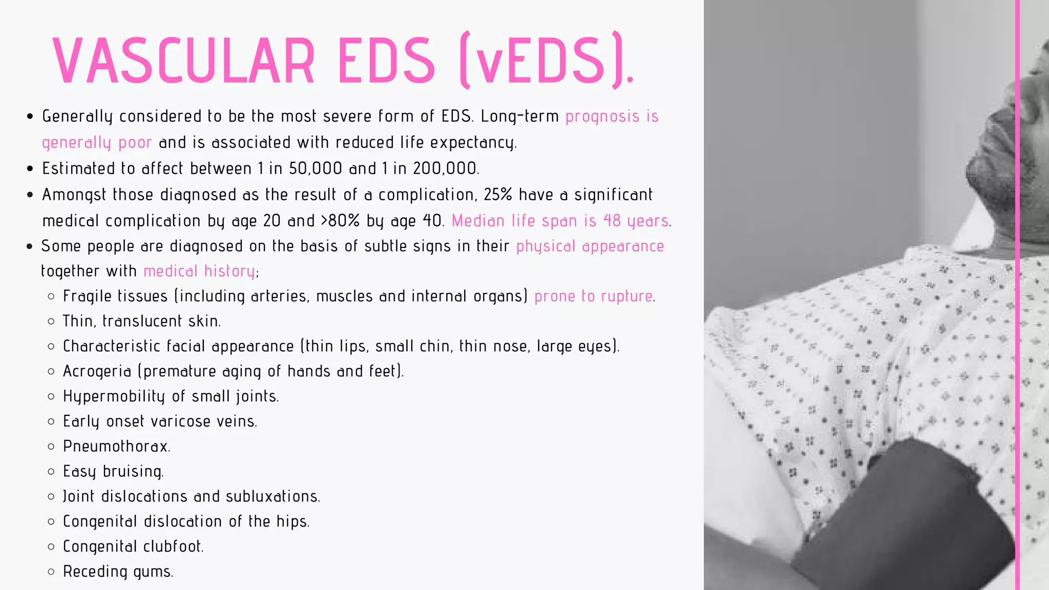 Hypermobile Ehlers-Danlos Syndrome & hypermobility spectrum disorders ...