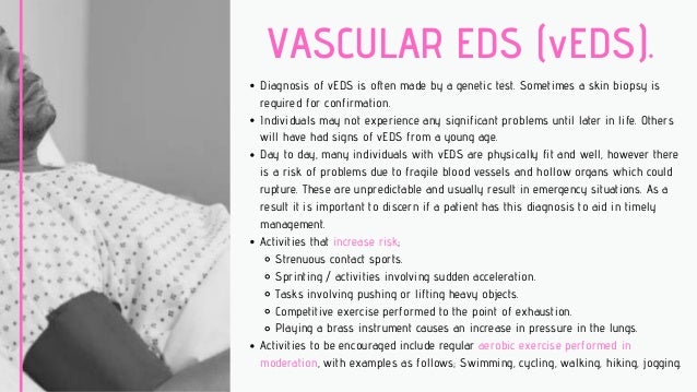 Hypermobile Ehlers-Danlos Syndrome & hypermobility spectrum disorders…