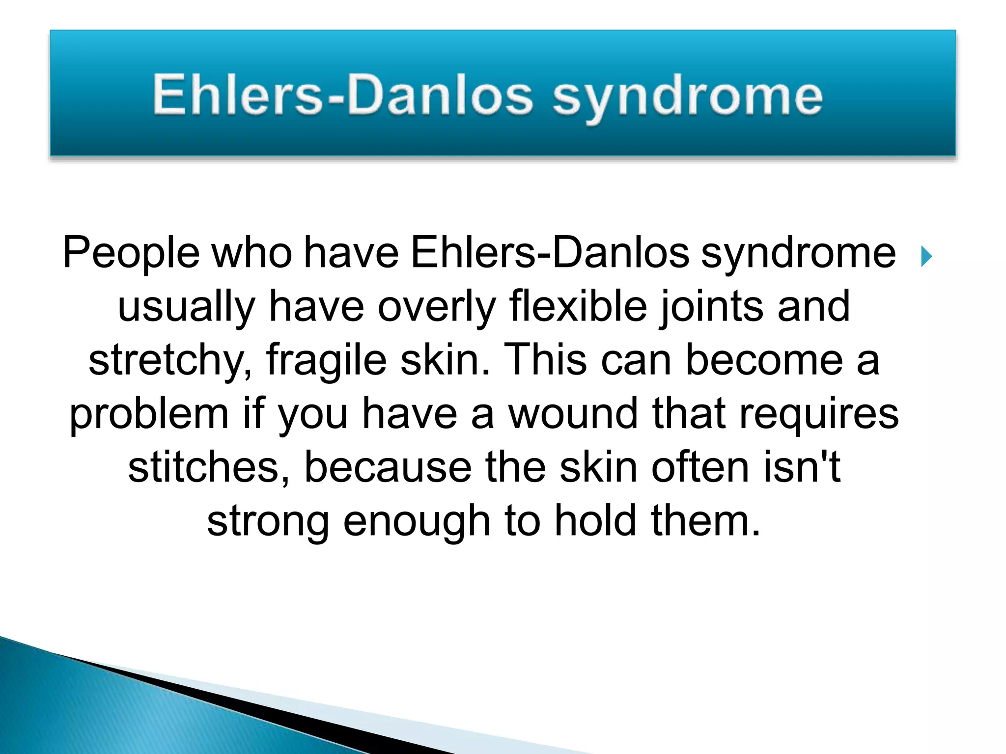 Ehlers danlos syndrome | PPTX