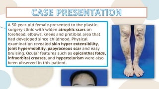 Ehlers danlos syndrome case.pptx