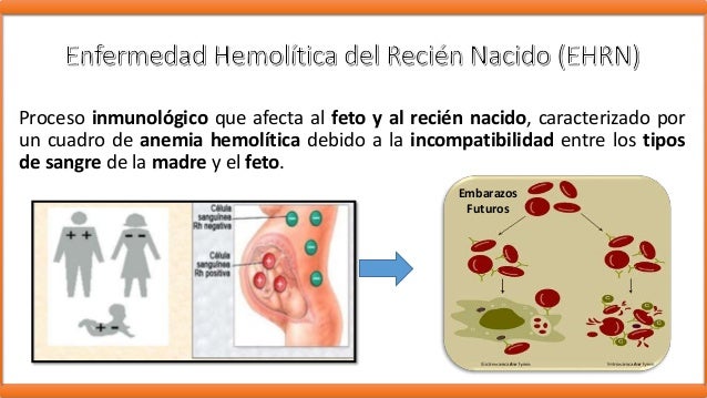 Enfermedad Hemolítica del Recién Nacido