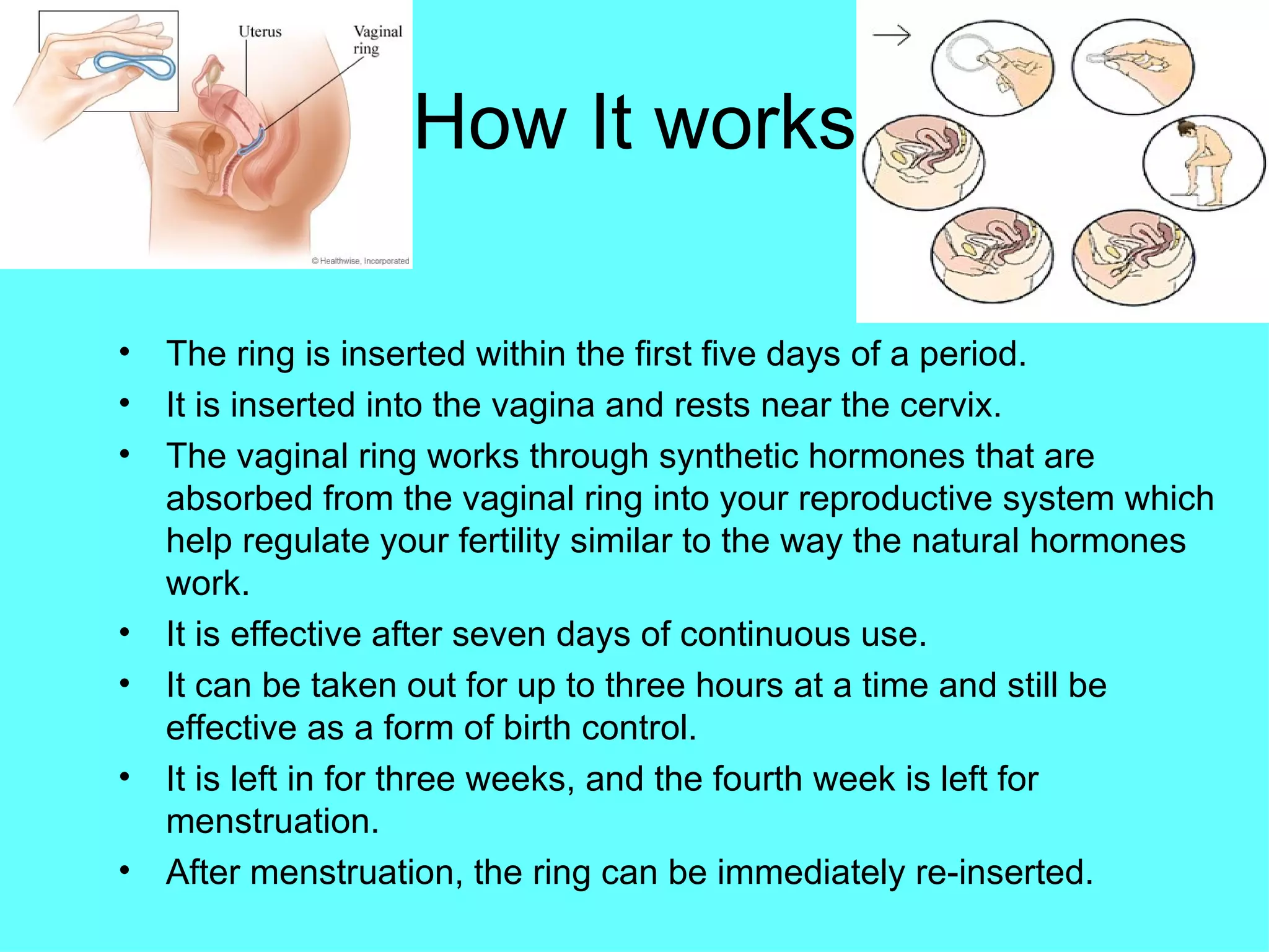 Forms Of Contraception | PPT