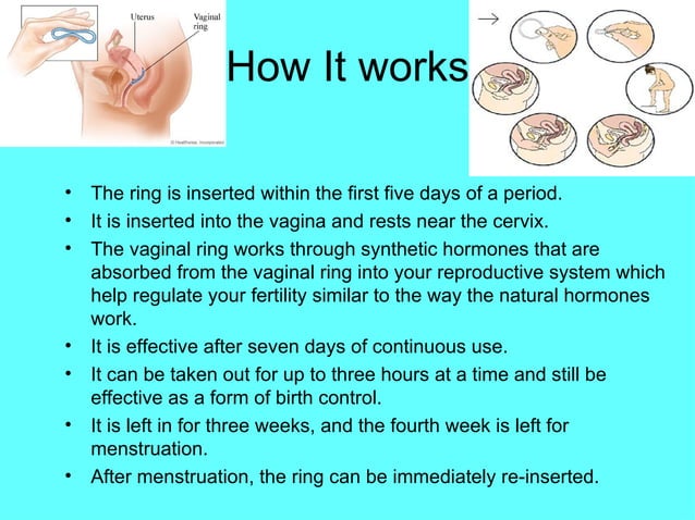 Forms Of Contraception | PPT