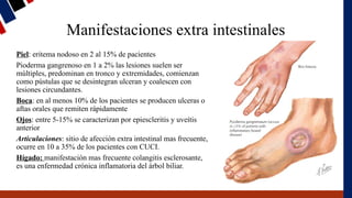 EII Enfermedad de Crohn y CUCI. gastroenterologiapptx | PPTX
