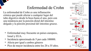 EII Enfermedad de Crohn y CUCI. gastroenterologiapptx | PPTX