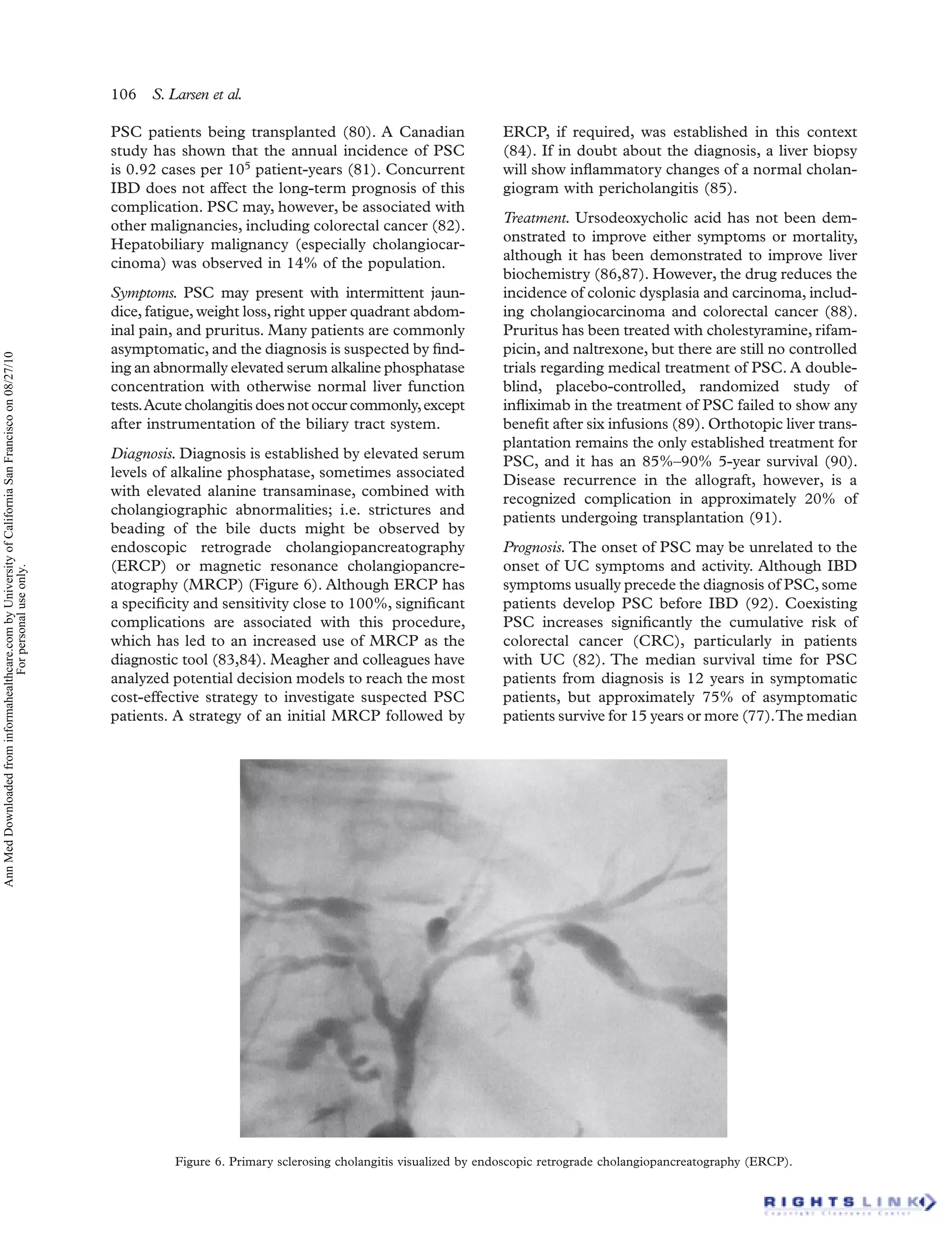 Eimibd - Extraintestinal manifestations of inflammatory bowel desease ...