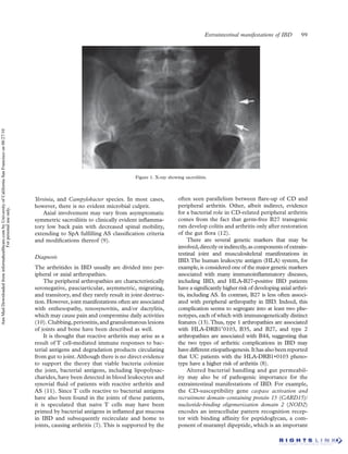 Eimibd - Extraintestinal manifestations of inflammatory bowel desease ...
