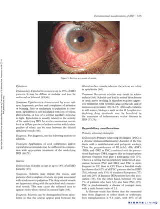 Eimibd - Extraintestinal manifestations of inflammatory bowel desease ...