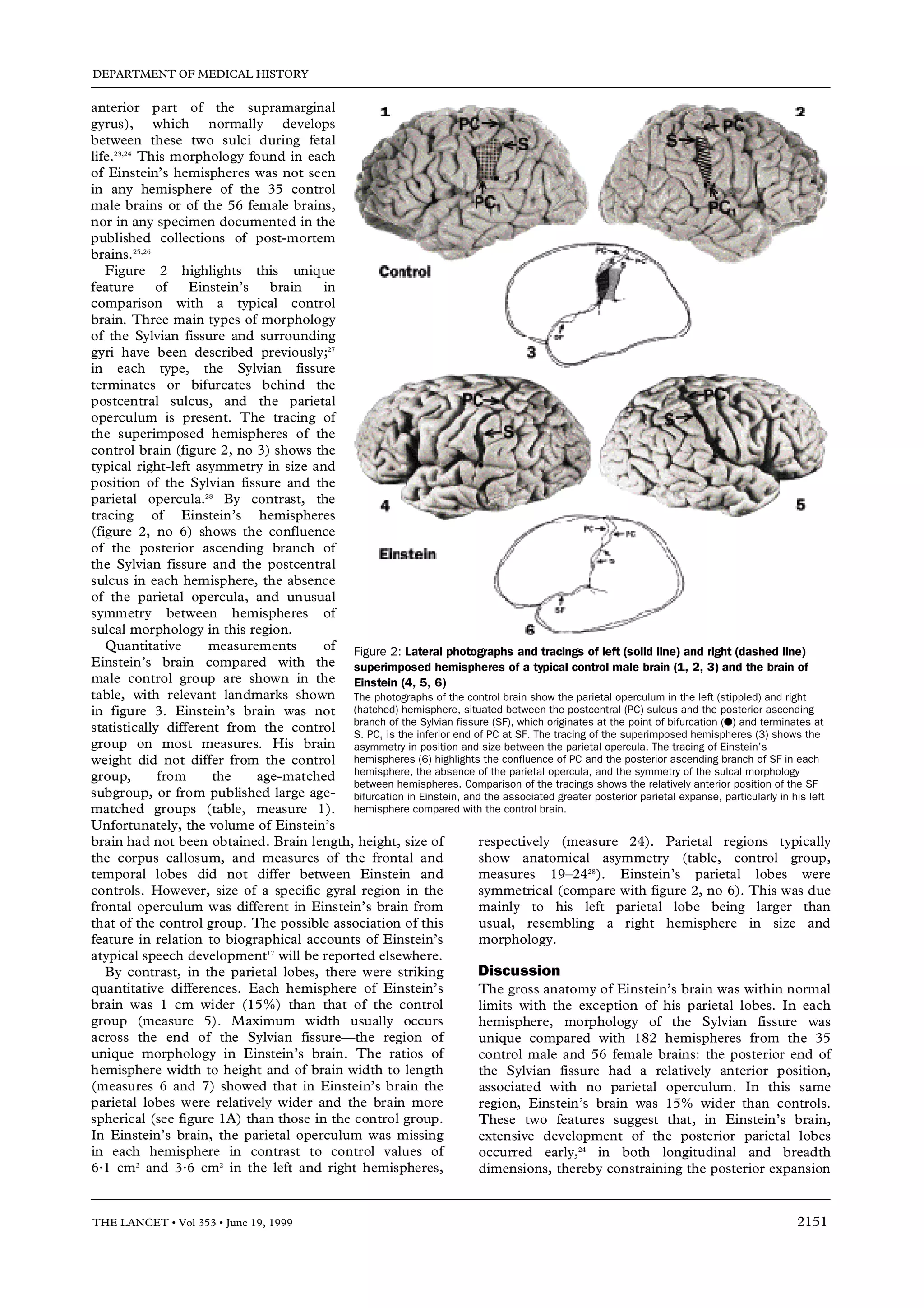 Einstein lancet '99 | PDF
